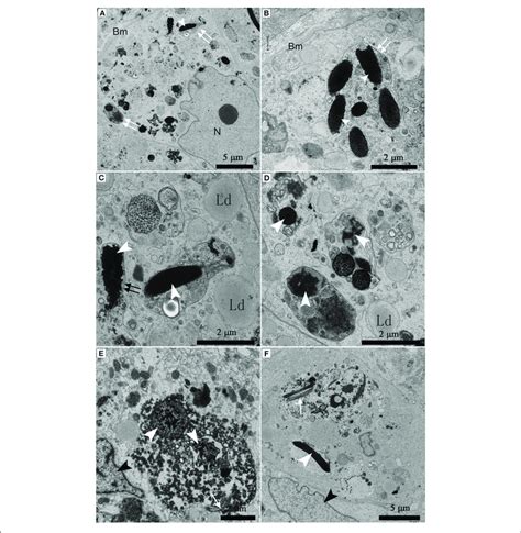 Tem Photograph Of Sertoli Cells Of The St Many Entotic Vacuoles Of
