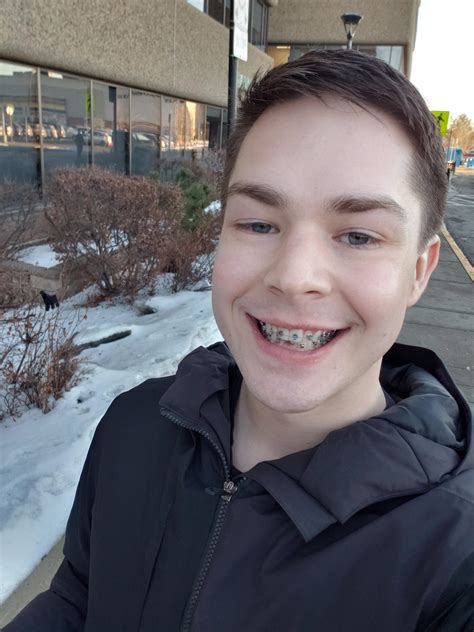 Stoked To Finally Have Braces At 26 R Braces