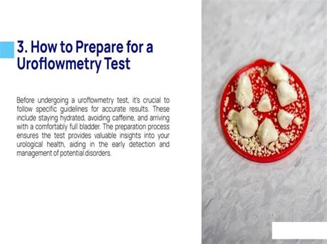 Understanding Uroflowmetry A Definitive Guide For Patients Pptx Medical Health
