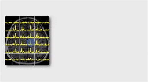 A Subspace Approach To Spectral Quantification For Mr Spectroscopic Imaging Ieee Transactions