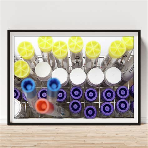 Microbial Sample Transport Swabs And Tubes Poster By Science Photo Library Science Photo Gallery