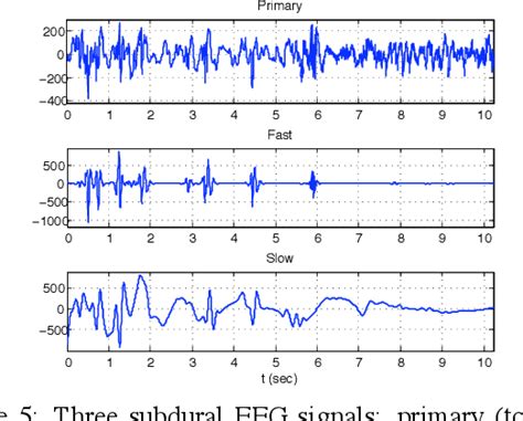 figure 1 from compressive sensing and random filtering of eeg signals