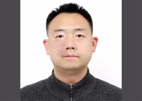 Dr Yukun Zhou Receives Prestigious Wellcome Early Career Award Ucl Faculty Of Brain Sciences