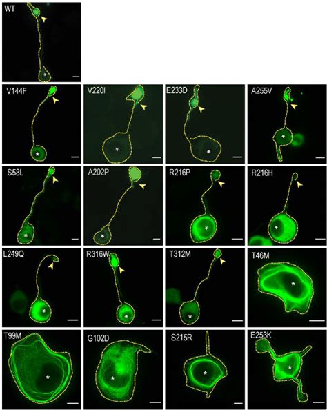 Sciencesaturday June 17 2023 Kif1a