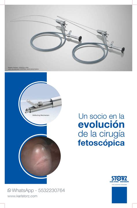 Karl Storz En Linkedin Medicinafetal Fetoscopia Ksem Oneks