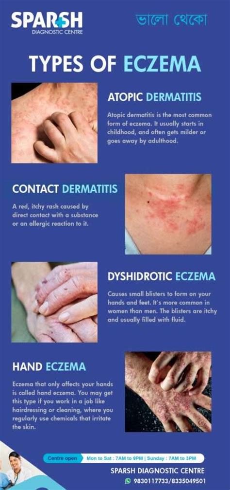 Eczema And Atopic Dermatitis Rashes Causes Symptoms Atopic Vs Contact