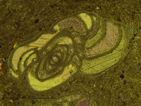 Microfossil Image Competition 2020 For 2021 Tms Calendar Winners