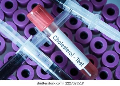 Cholesterol Test Stock Photos Images Photography Shutterstock