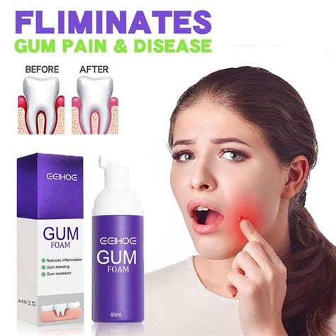 Gum Foam Beautiful Mousse Care Gum Deep Dirt Clean Teeth Protect Teeth