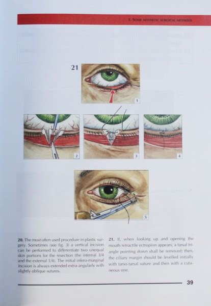 Techniques In Ophthalmo Facial Surgery Mircea Olteanu