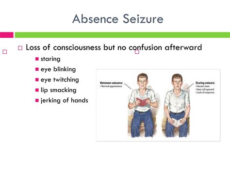 PPT Seizure Protocol PowerPoint Presentation Free Download ID