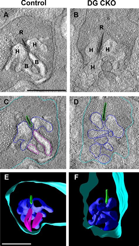 Electron Microscopic Analysis Of The Photoreceptor Ribbon Synapse In