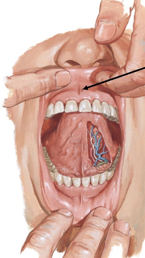 Netter Sist Digestório Flashcards Memorang