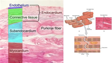 Myocardium Location