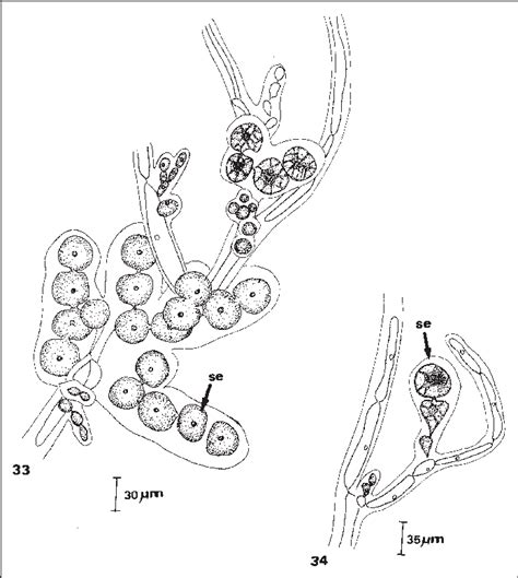 Seirospora Occidentalis Figura 33 Detalle De Las Seirosporas Se