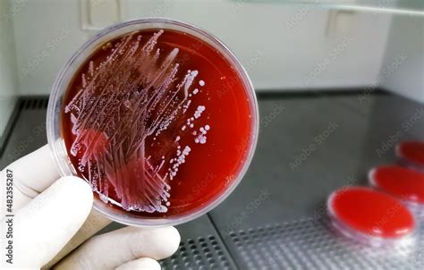 Staphylococcus Aureus Gram Positive To Gram Variable Nonmotile Coccus Beta Hemolysis