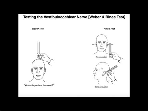 Ear Examination With Weber And Rinne Test Youtube Tinnitus The Sound
