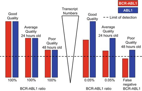 Optimal Monitoring Of Cml Treatment Molecular And Mutation Analysis