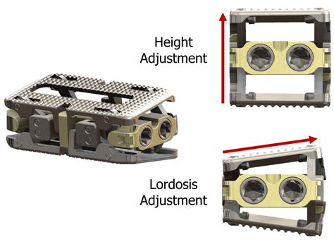 Io™ Lateral Expandable Mirus