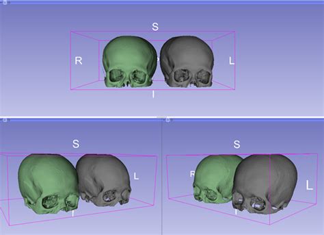3d Slicer中文教程（八）—导出stl文件 Csdn博客