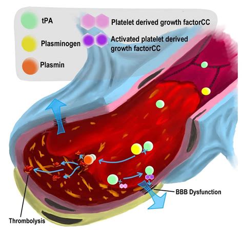 Deep Vein Thrombosis Dvt Symptoms Causes And Treatment