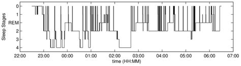 Fig A1 A Human Hypnogram Sleep Wake Stage Scoring Has Been Realized