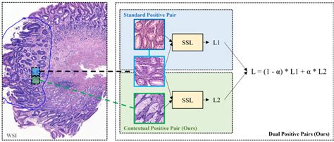 논문 리뷰 Spatial Context Driven Positive Pair Sampling for Enhanced Histopathology Image