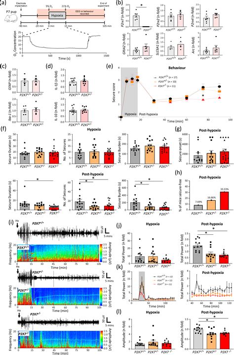 The P2x7 Receptor Contributes To Seizures And Inflammation Driven Long