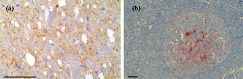 Immunohistochemical Detection Of Prp Sc In The Obex Region Of The Cns Download Scientific