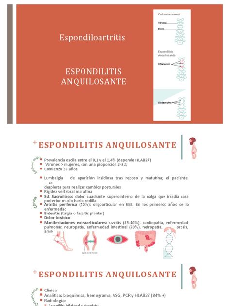 Espondilitis Anquilosante Pdf