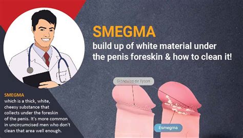 Smegma Definition Prevention And How To Get Rid Of It