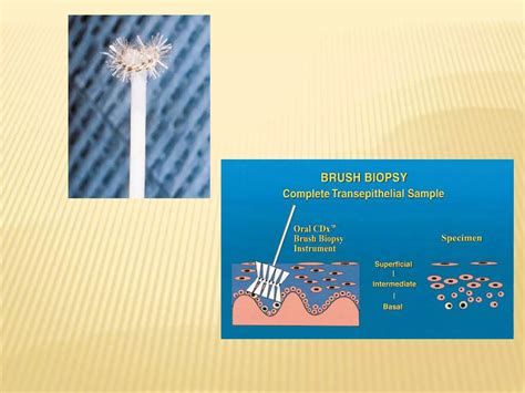 Biopsy Oral Pathology Pptx