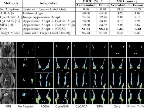 Quantitative Comparative Results Between Our Method And Other State Of