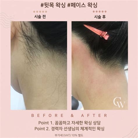 잔머리 깔끔한 라인 정리는 뒷목왁싱으로 네이버 블로그