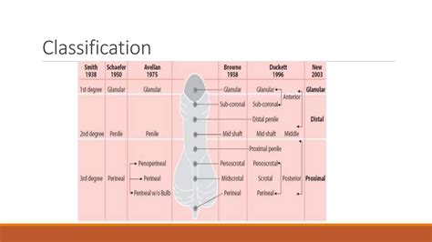 Hypospadias Ppt Pptx