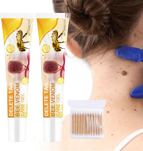 Wree Bee Venom Wart And Tag Remover Wree Bee Venom Wart And Tag