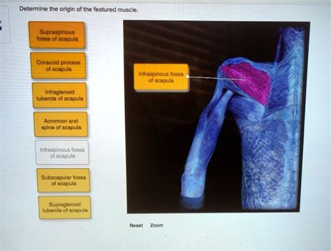 Solved Determine The Origin Of The Featured Muscle Supraspinous Fossa Of Scapula Coracoid