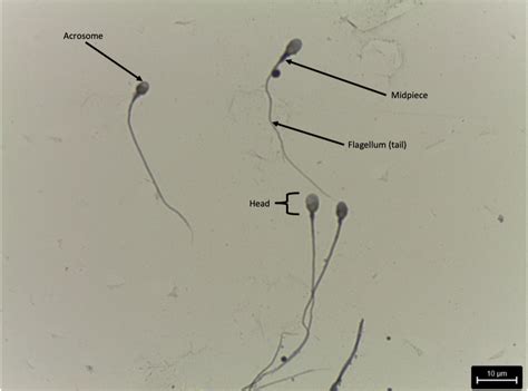 Practical 4 Sperm Slide Diagram Quizlet