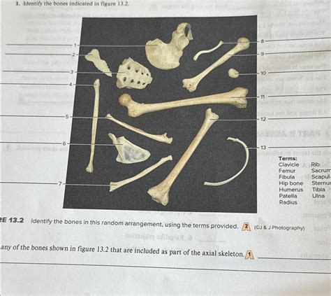 Solved Identify The Bones Indicated In Figure 13 2 Re