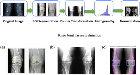 Entropic Segmentation And Histogram Equalization Download Scientific
