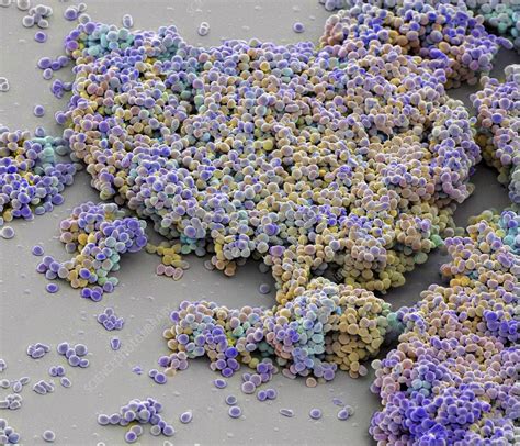 Lactococcus Lactis Bacteria Stock Image F043 1155 Science Photo