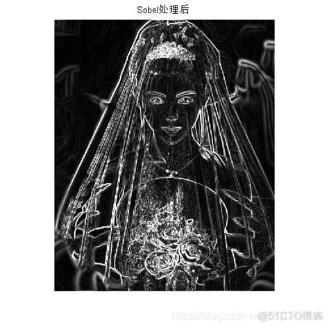 【图像处理】基于matlab Gui数字图像处理【含matlab源码 652期】51cto博客基于matlab Gui的数字图像处理