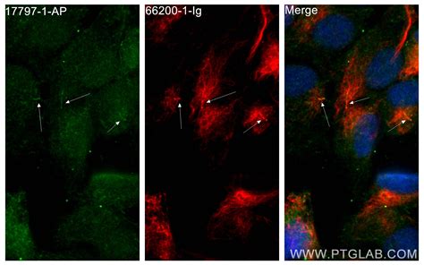Inpp5e Antibody 17797 1 Ap Proteintech