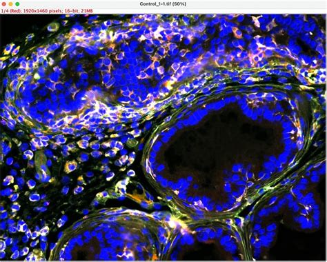 Cell Detection Parameters What Are Each Of The Settings And