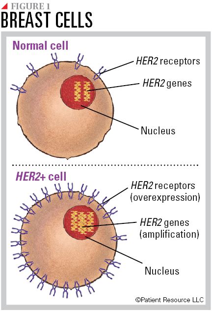 Breast Cancer Her2 Overview And Staging