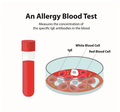 Allergen Testing Creative Diagnostics