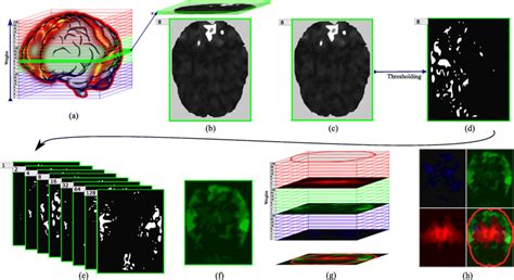 Volume Reduction Process In An Axial Rgb Image A Schematization Of The Download Scientific