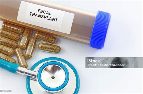 대변 이식 또는 대변 이식 클로스트리디움 박테리아 감염과 같은 지속적인 소화기 질환을 치료하기 위한 분변 미생물군이 포함된 알약 또는 의약품 이식수술에 대한 스톡 사진 및