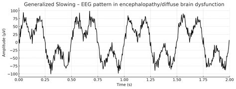 Electroencephalography Eeg Interpretation And Clinical Use The