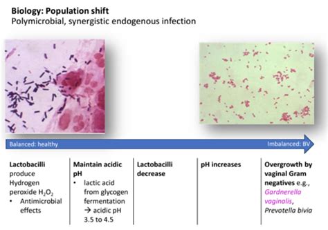 Genital Tract Infections Flashcards Quizlet